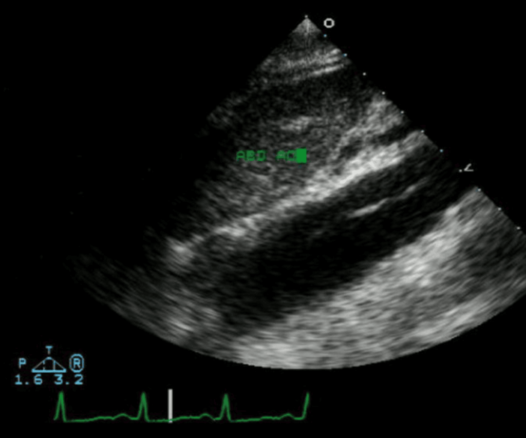 Echocardiography – Heart Centre Ranchi